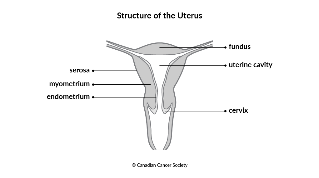 Stages Of Uterine Cancer Canadian Cancer Society Stages Of Uterine Cancer Canadian Cancer Society